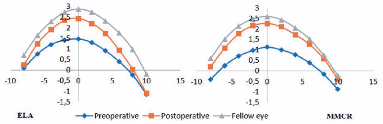 Arquivos Brasileiros de Oftalmologia - Digital analysis of unilateral ...